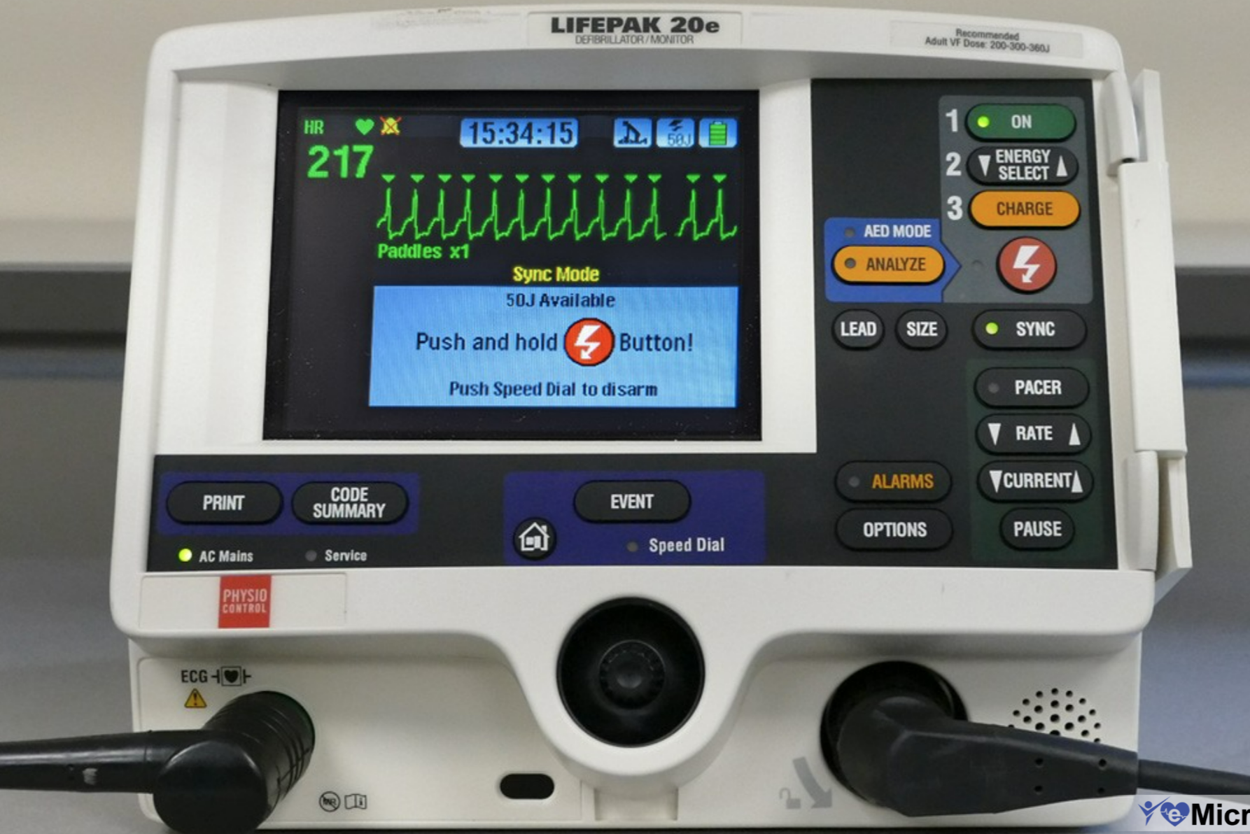 Synchronized Cardioversion - UAB Clinical Simulation